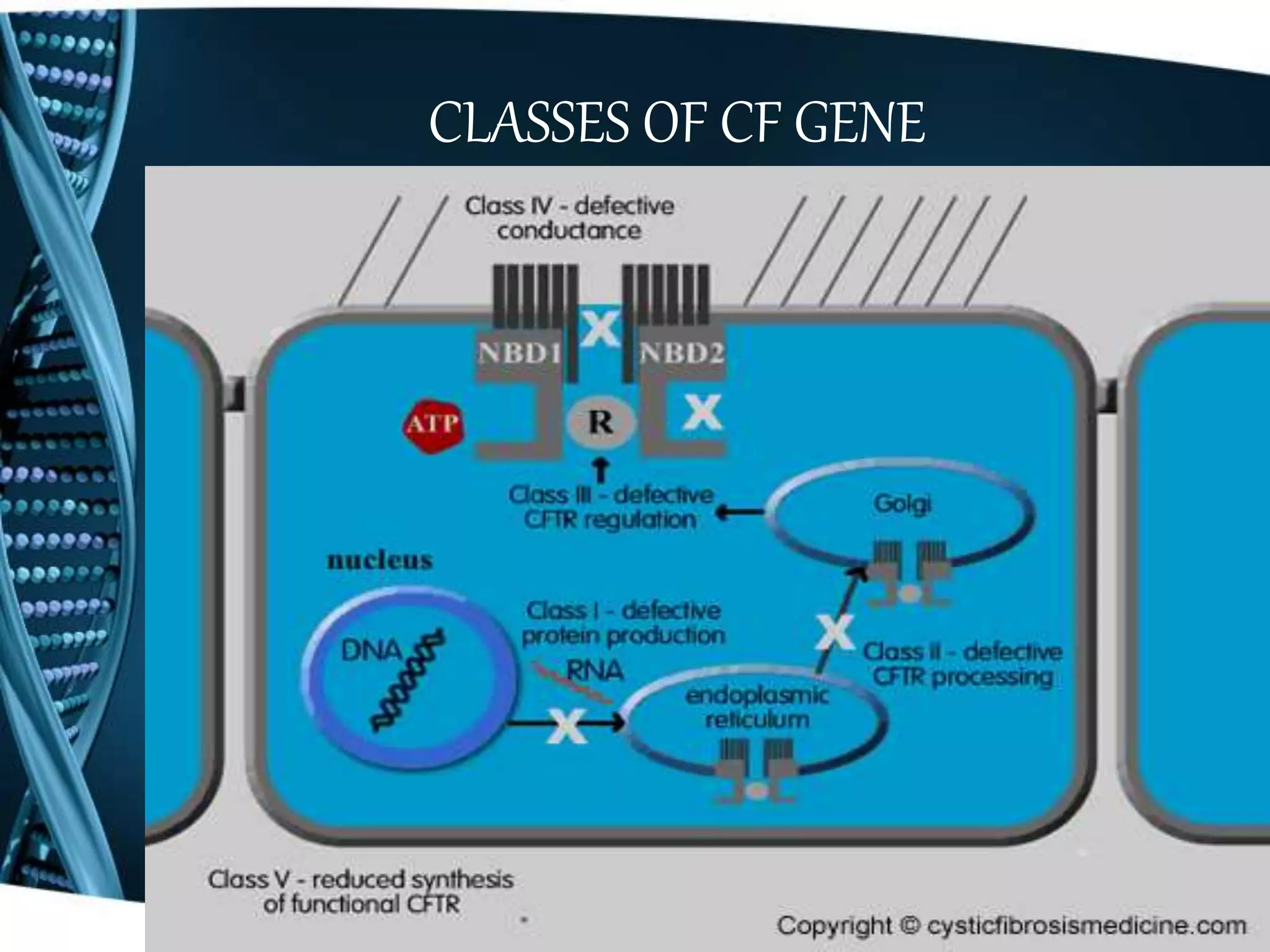Cystic fibrosis (genetics) | PPTX