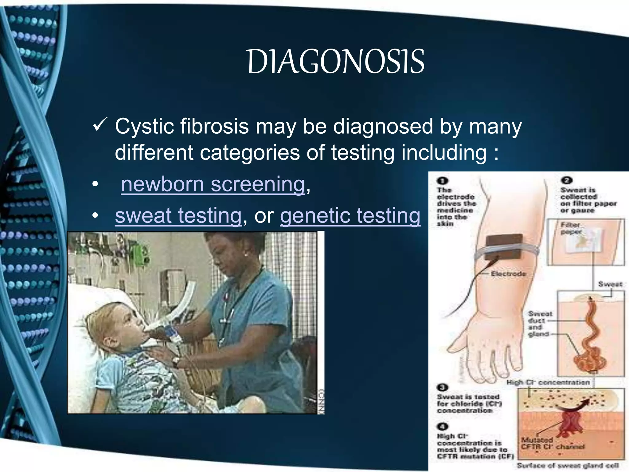 Cystic fibrosis (genetics) | PPTX
