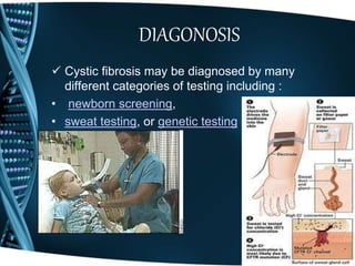 Cystic fibrosis (genetics) | PPTX