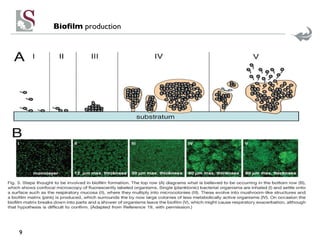 Cystic Fibrosis Infections | PPT