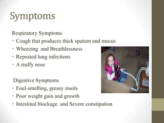 Cystic fibrosis presentation | PPTX