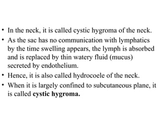 CYSTIC HYGROMA FOR CHILDREN AND ADULTING | PPTX