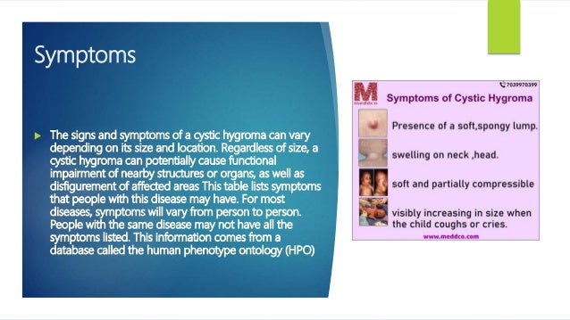 Cystic Hygroma ppt.pptx