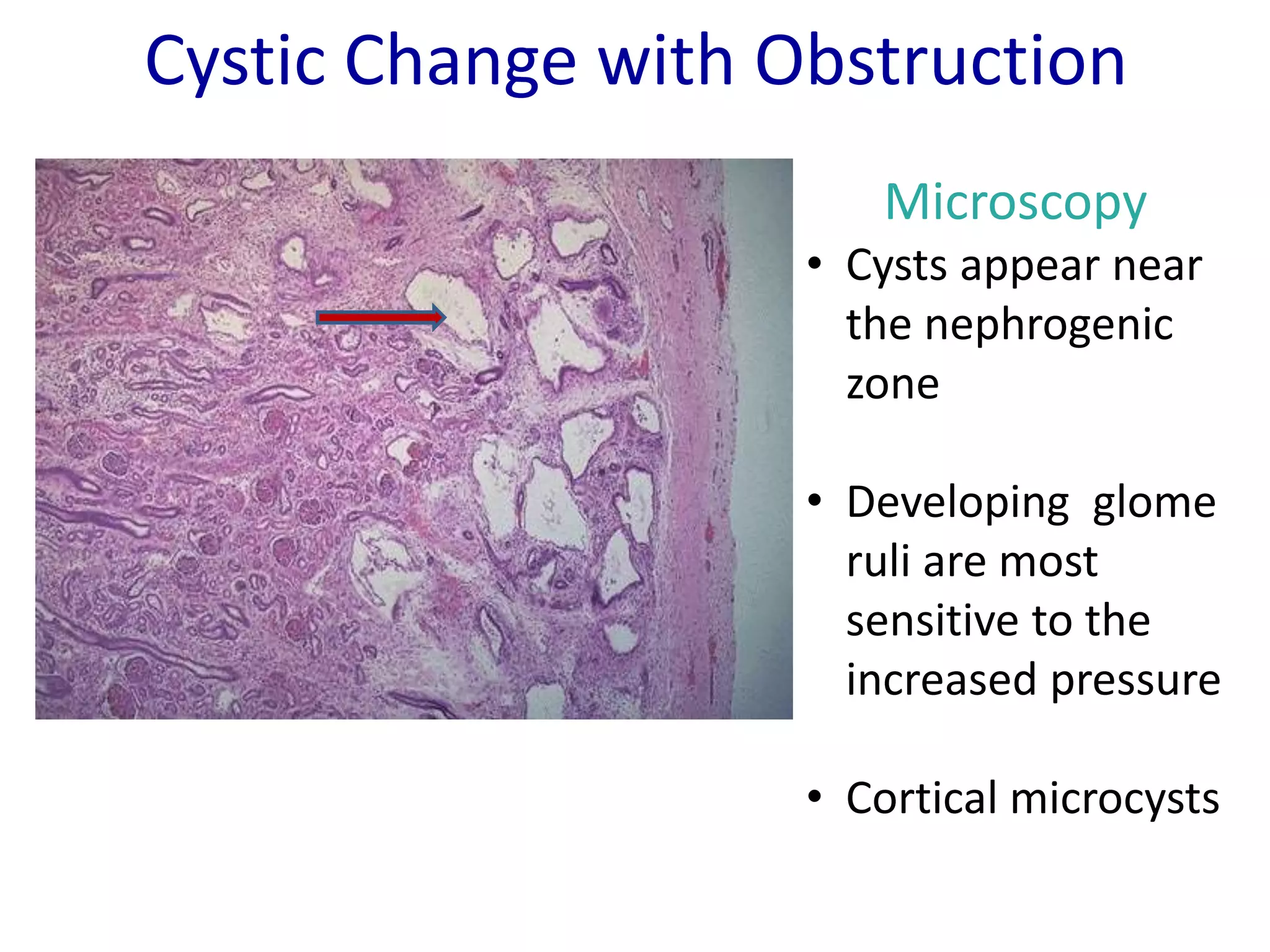 cystic kidney.pptx