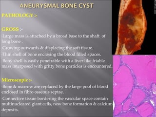 Cystic lesion of bones | PPT