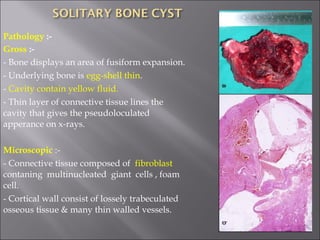 Cystic lesion of bones | PPT
