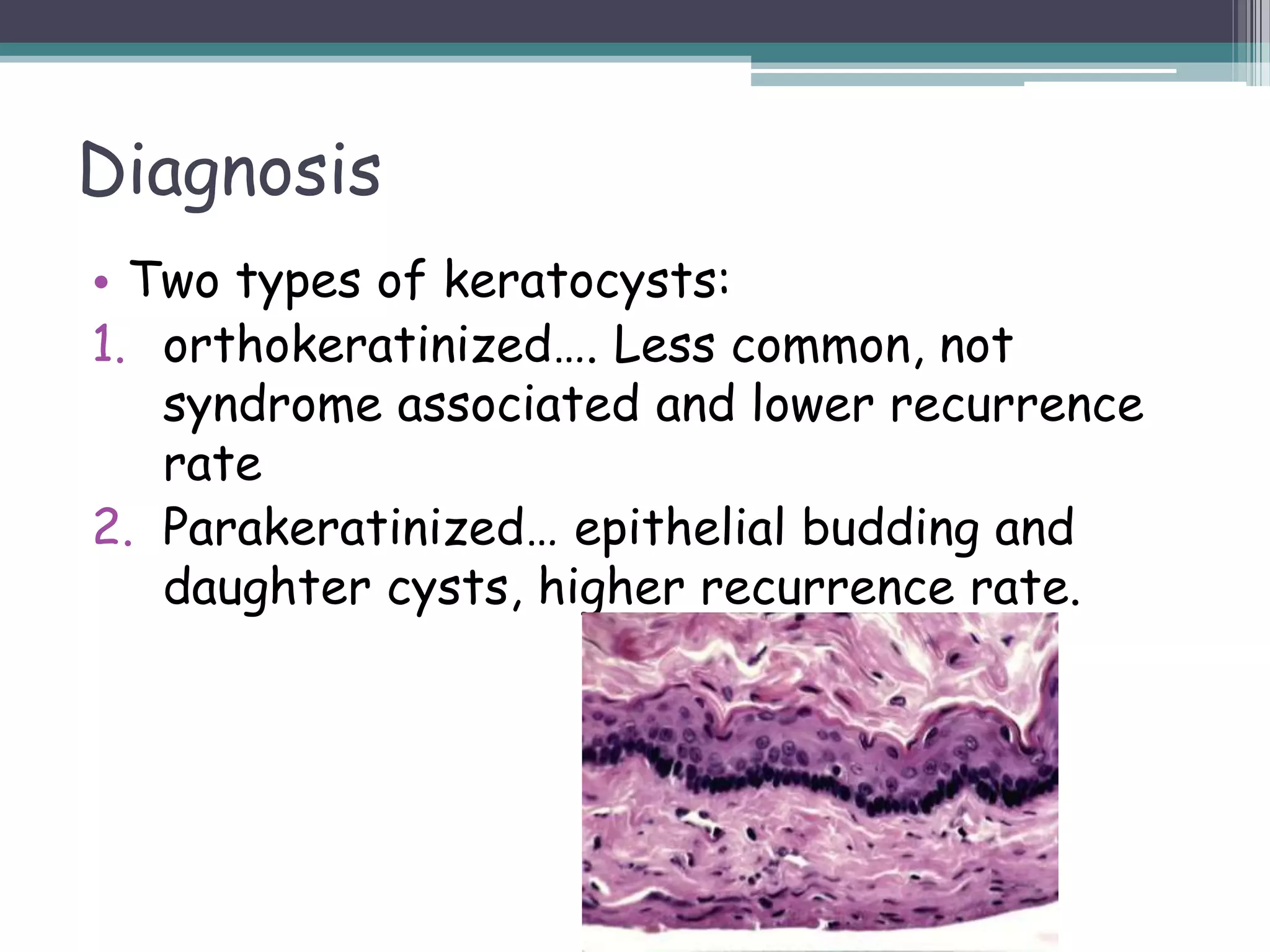 Cystic lesions in oral cavity | PPTX
