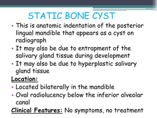 Cystic lesions in oral cavity | PPTX