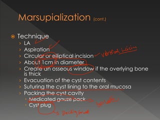 Cystic lesions_powerpoint……………………….).pdf