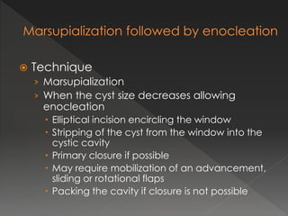 Cystic lesions_powerpoint……………………….).pdf