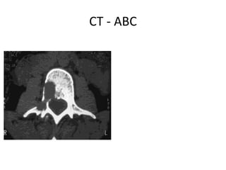 Cystic lesions of bone | PPTX