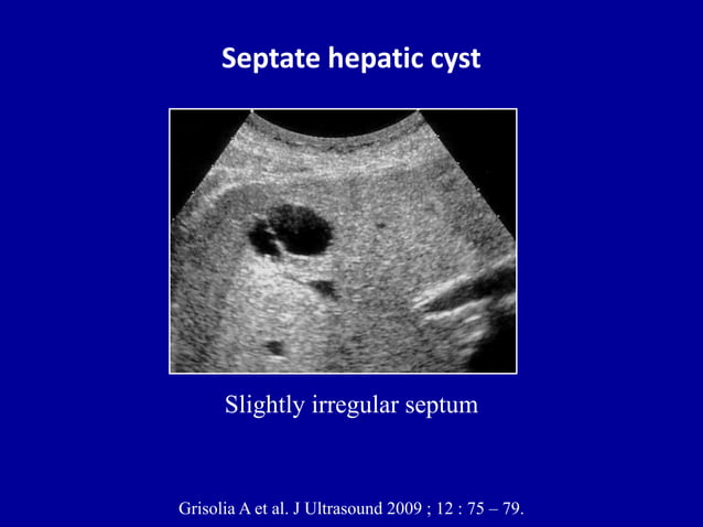 Cystic liver lesions - An ultrasound perspective | PPTX