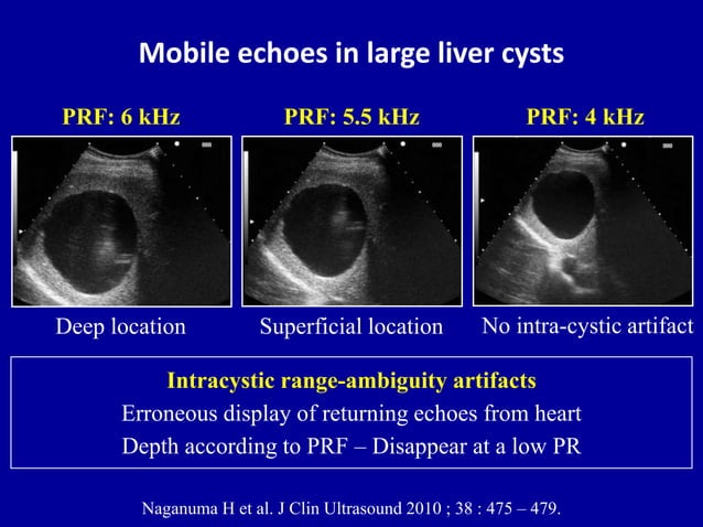 Cystic liver lesions - An ultrasound perspective | PPTX