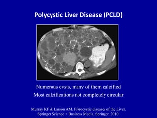 Cystic liver lesions - An ultrasound perspective | PPTX