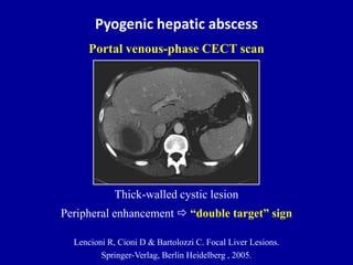 Cystic liver lesions - An ultrasound perspective | PPTX