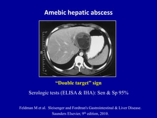 Cystic liver lesions - An ultrasound perspective | PPTX