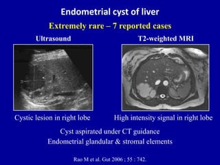 Cystic liver lesions - An ultrasound perspective | PPTX