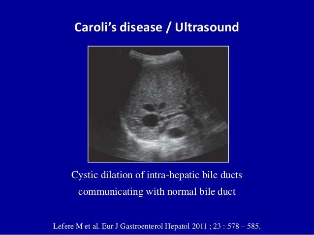 Cystic liver lesions - An ultrasound perspective