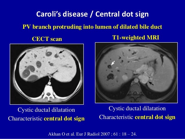 Cystic liver lesions - An ultrasound perspective
