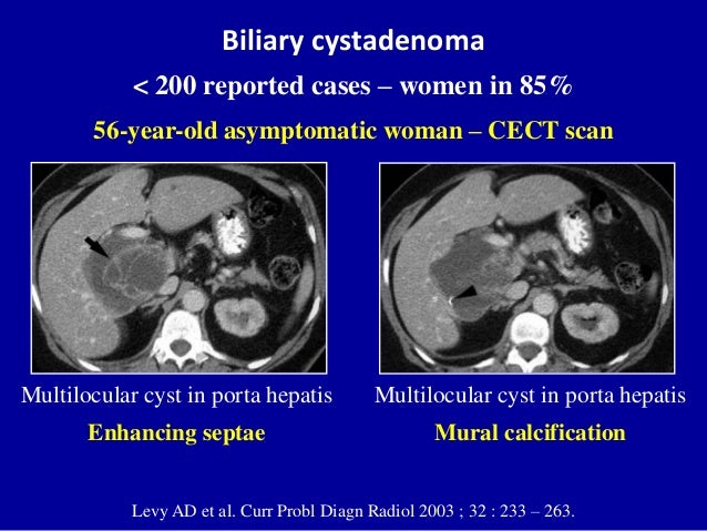 Cystic liver lesions - An ultrasound perspective