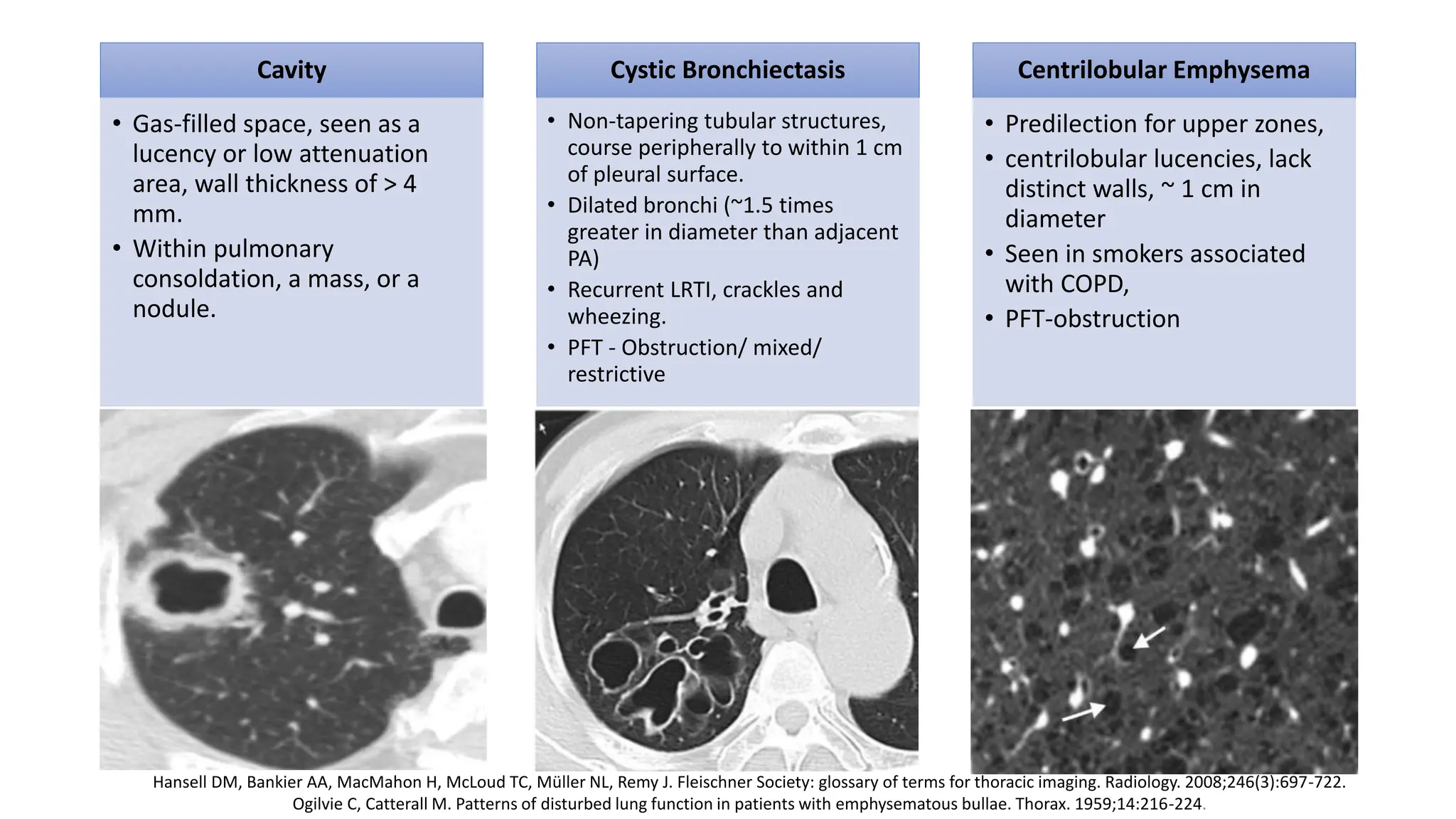 CYSTIC LUNG DISEASES - types and Radiology.pptx