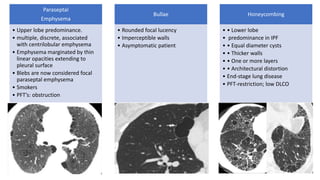 CYSTIC LUNG DISEASES - types and Radiology.pptx