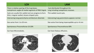 CYSTIC LUNG DISEASES - types and Radiology.pptx