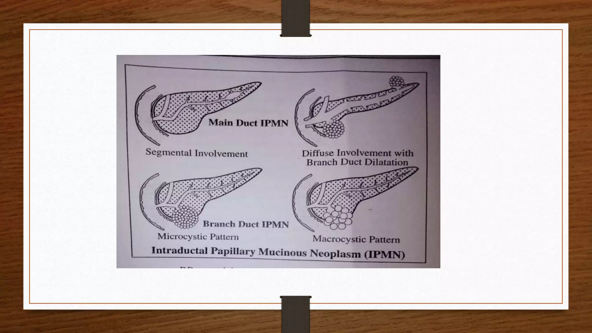 Cystic masses of pancreas.pptx