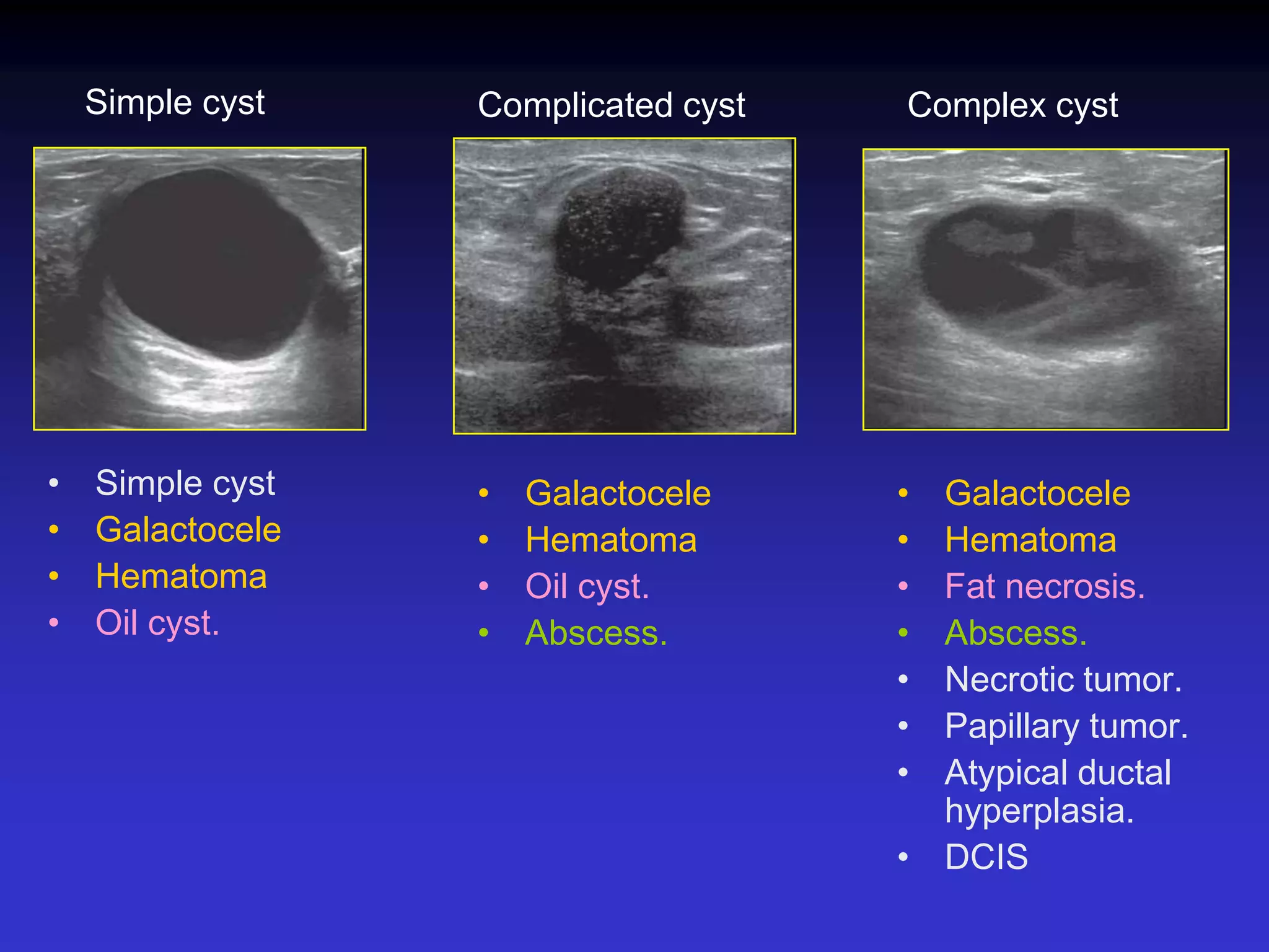 Cystic masses of the breast by xiu | PPT | Blood Disorders | Diseases ...