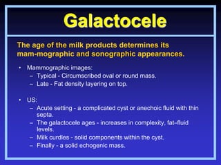 Cystic masses of the breast by xiu | PPT