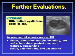 Cystic masses of the breast by xiu | PPT