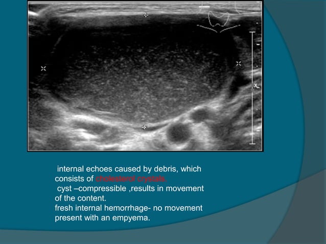 cystic neck lesions congenital and acquired | PPT