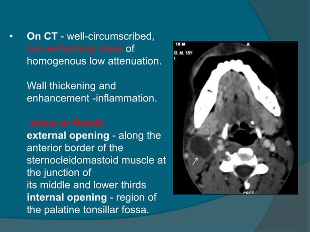 cystic neck lesions congenital and acquired | PPT