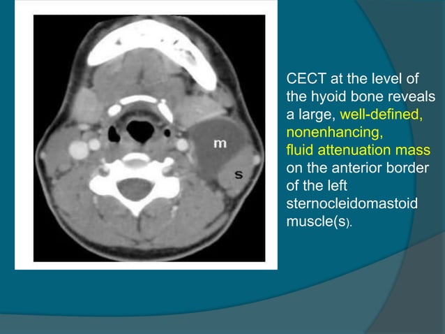 cystic neck lesions congenital and acquired | PPT