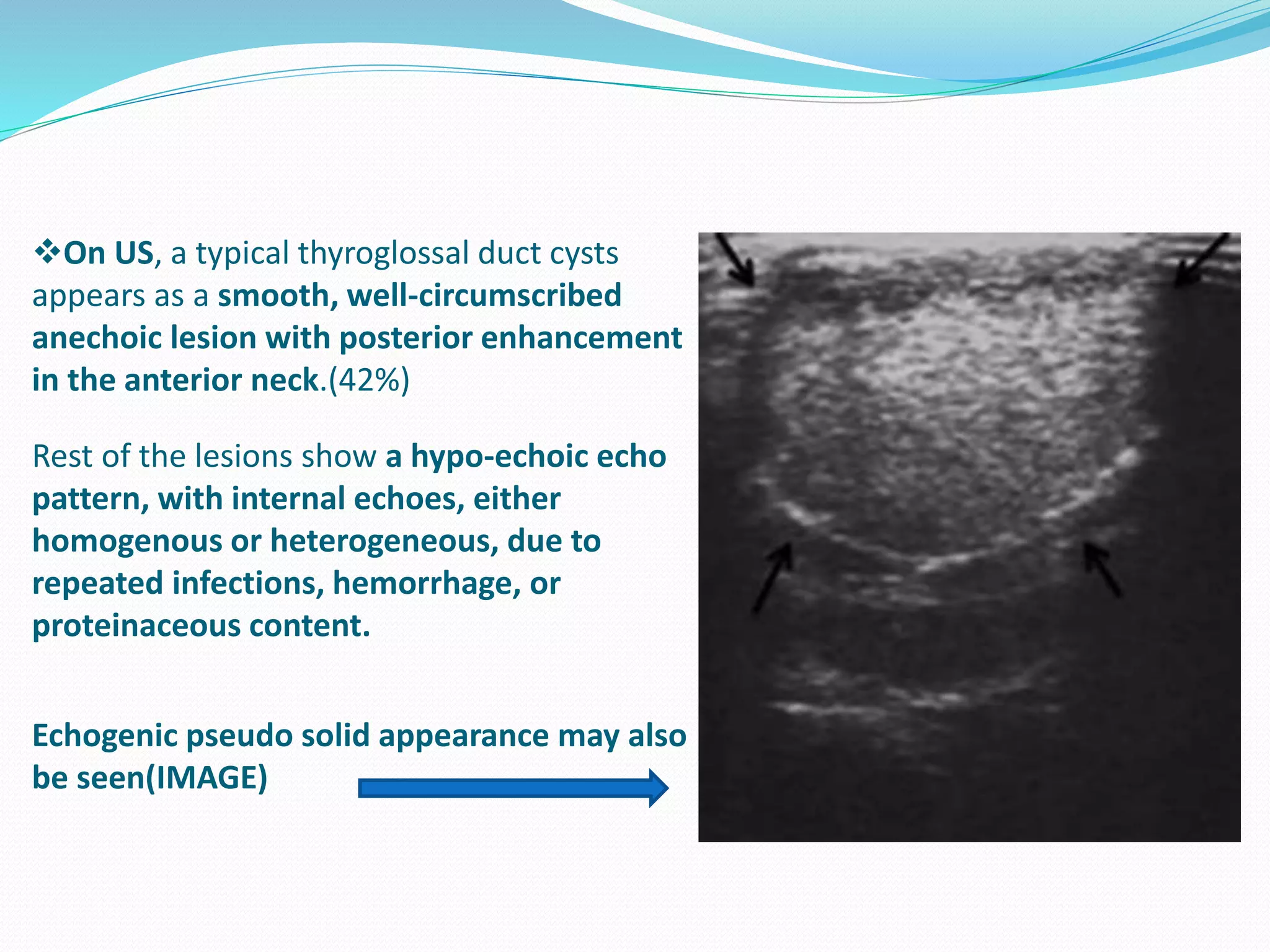 Cystic masses of neck | PPTX