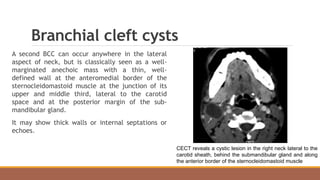 Cystic neck masses | PPTX