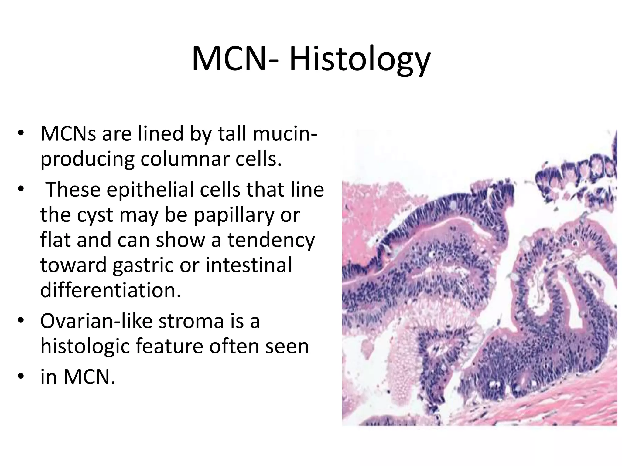Cystic neoplasm of pancreas | PPTX