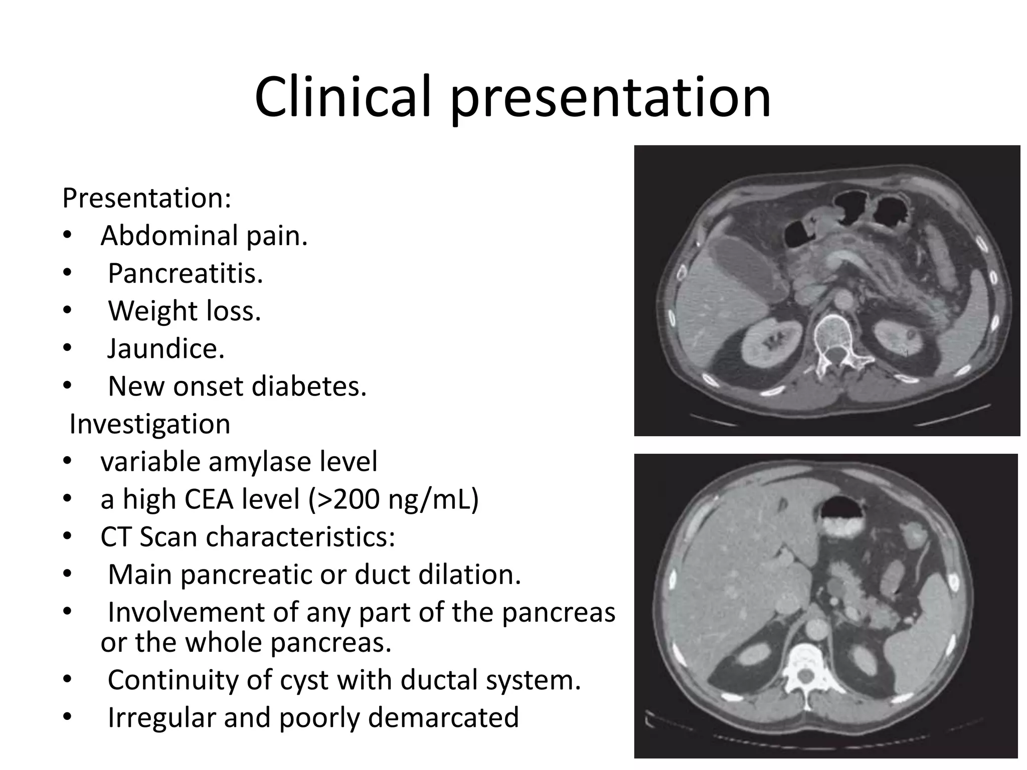 Cystic neoplasm of pancreas | PPTX