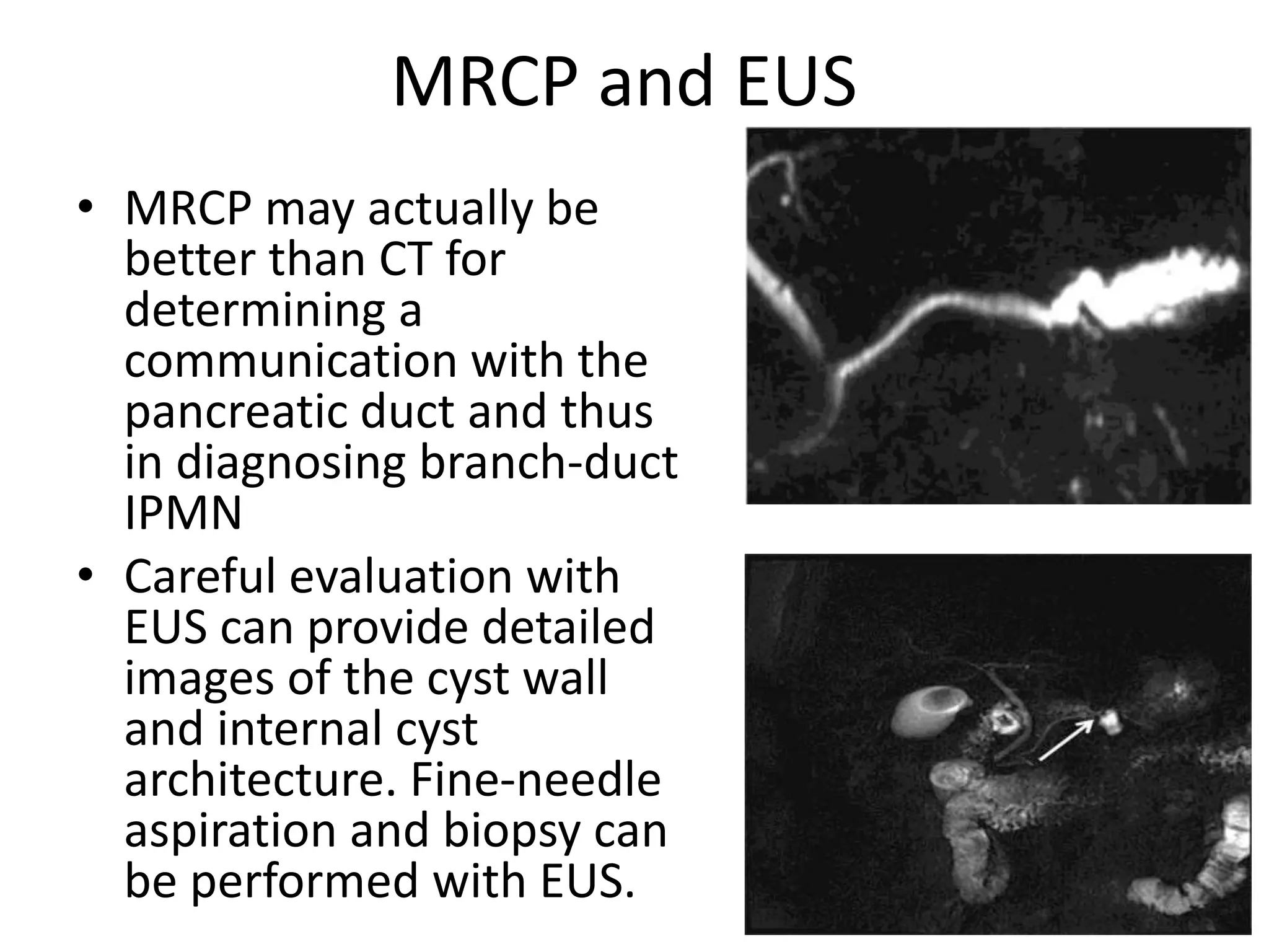 Cystic Neoplasm Of Pancreas Ppt