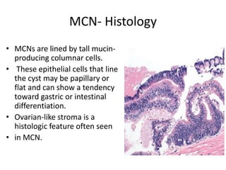 Cystic neoplasm of pancreas | PPTX