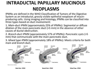 Cystic neoplasm of pancreas | PPTX