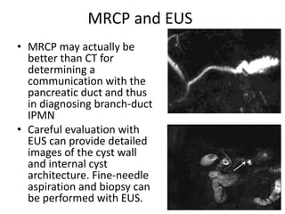 Cystic neoplasm of pancreas | PPT