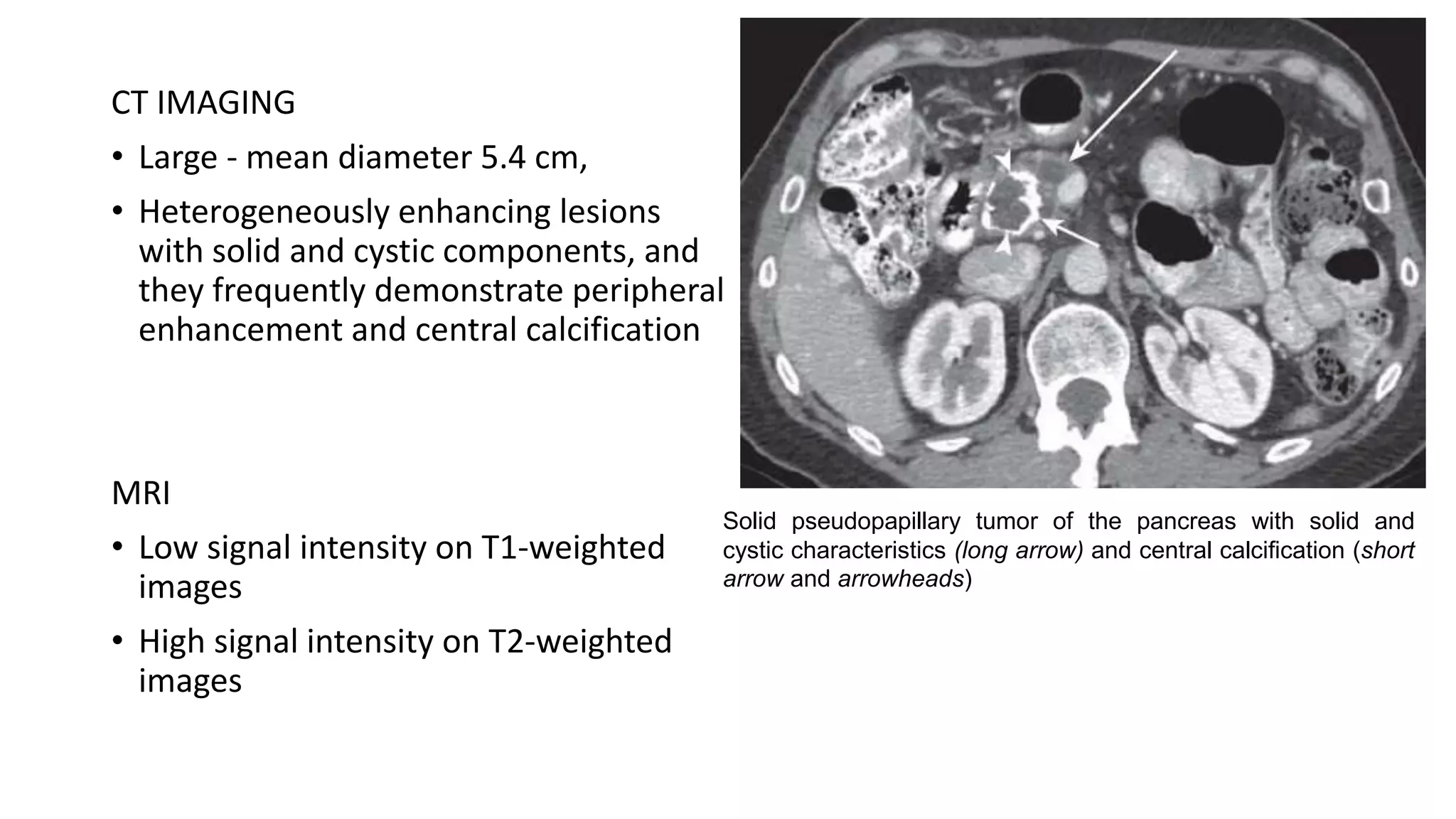 cystic neoplasm of pancreas | PPTX