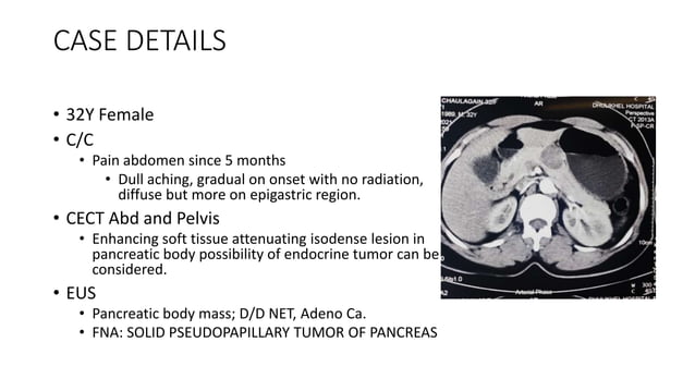 cystic neoplasm of pancreas | PPTX
