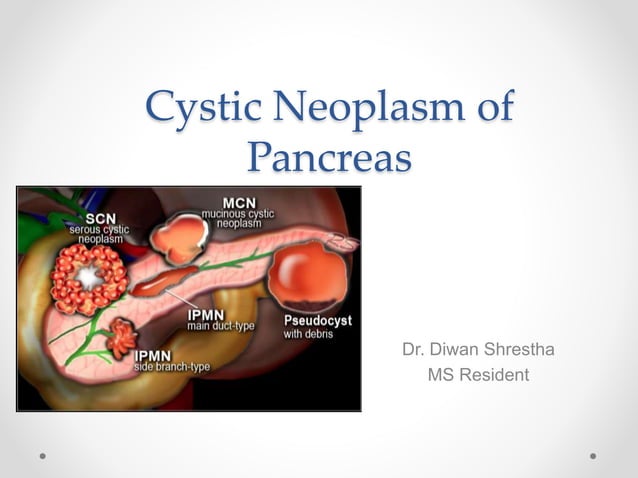 Cystic neoplasm of pancreas | PPTX | Endocrine and Metabolic Diseases | Diseases and Conditions