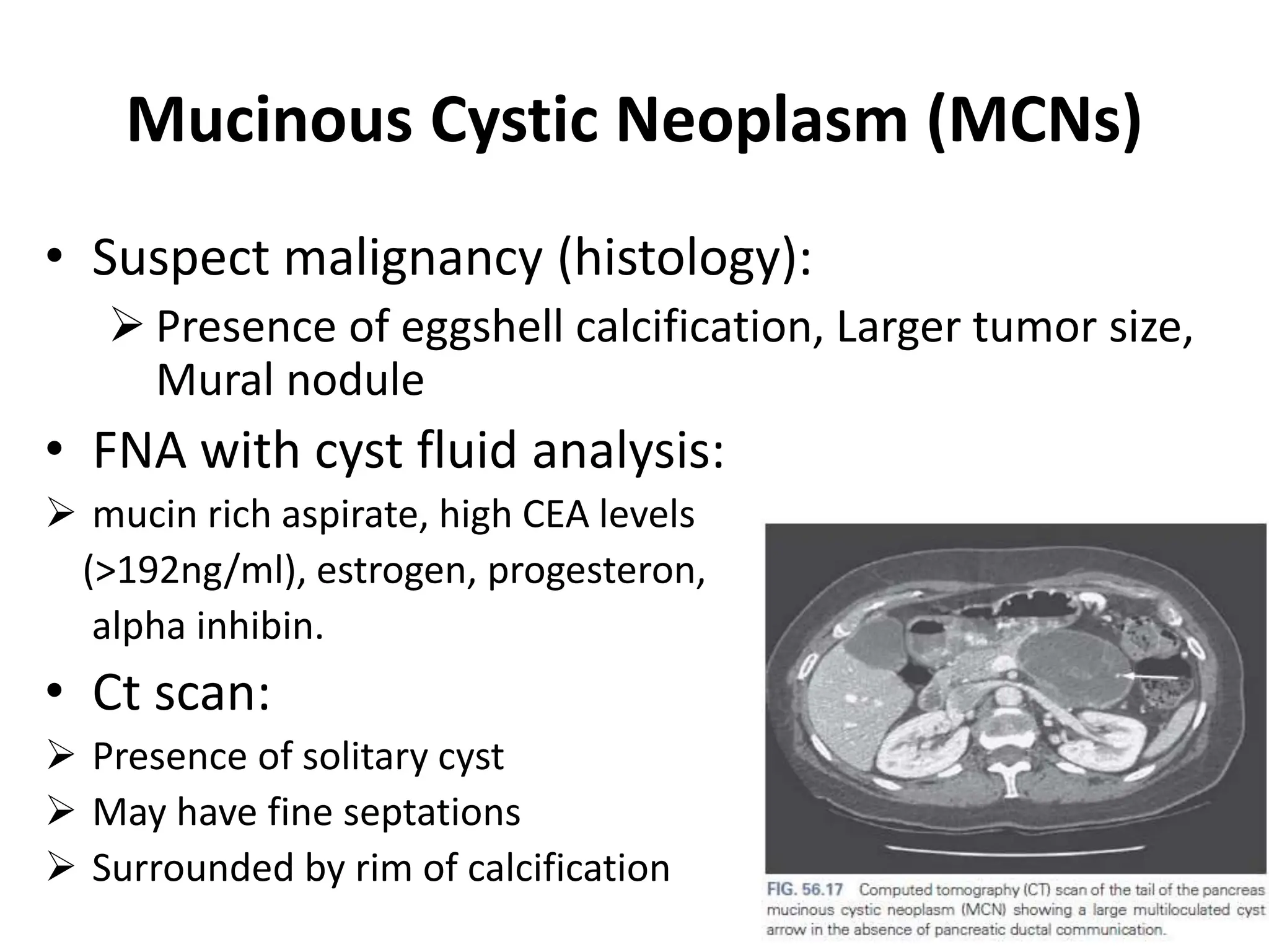 Basics On Cystic Neoplasms Of The Pancreaspptx