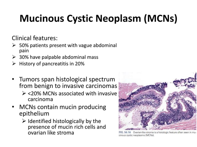 basics on Cystic neoplasms of the pancreas.pptx