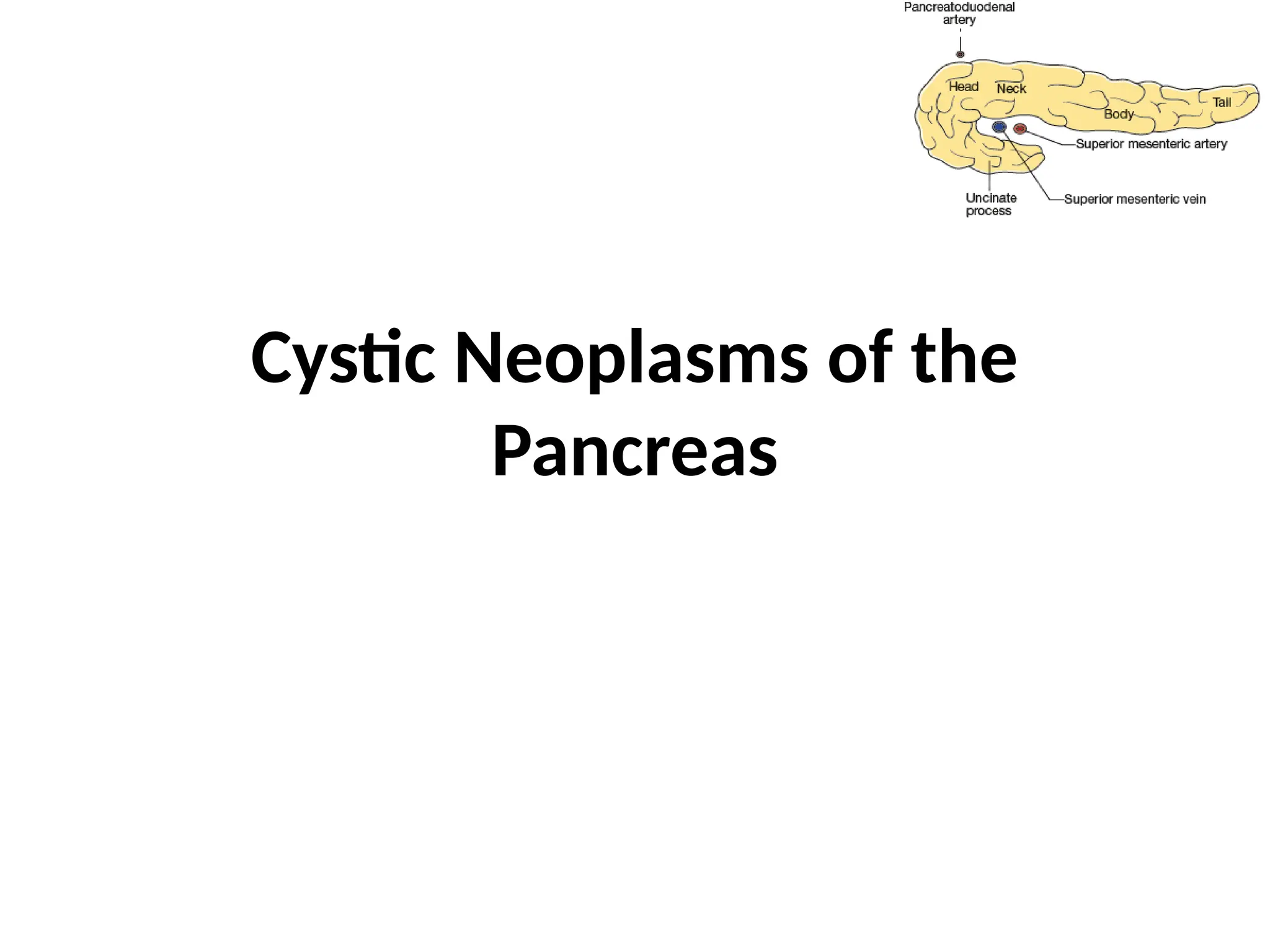 basics of Cystic neoplasms of the pancreas.pptx