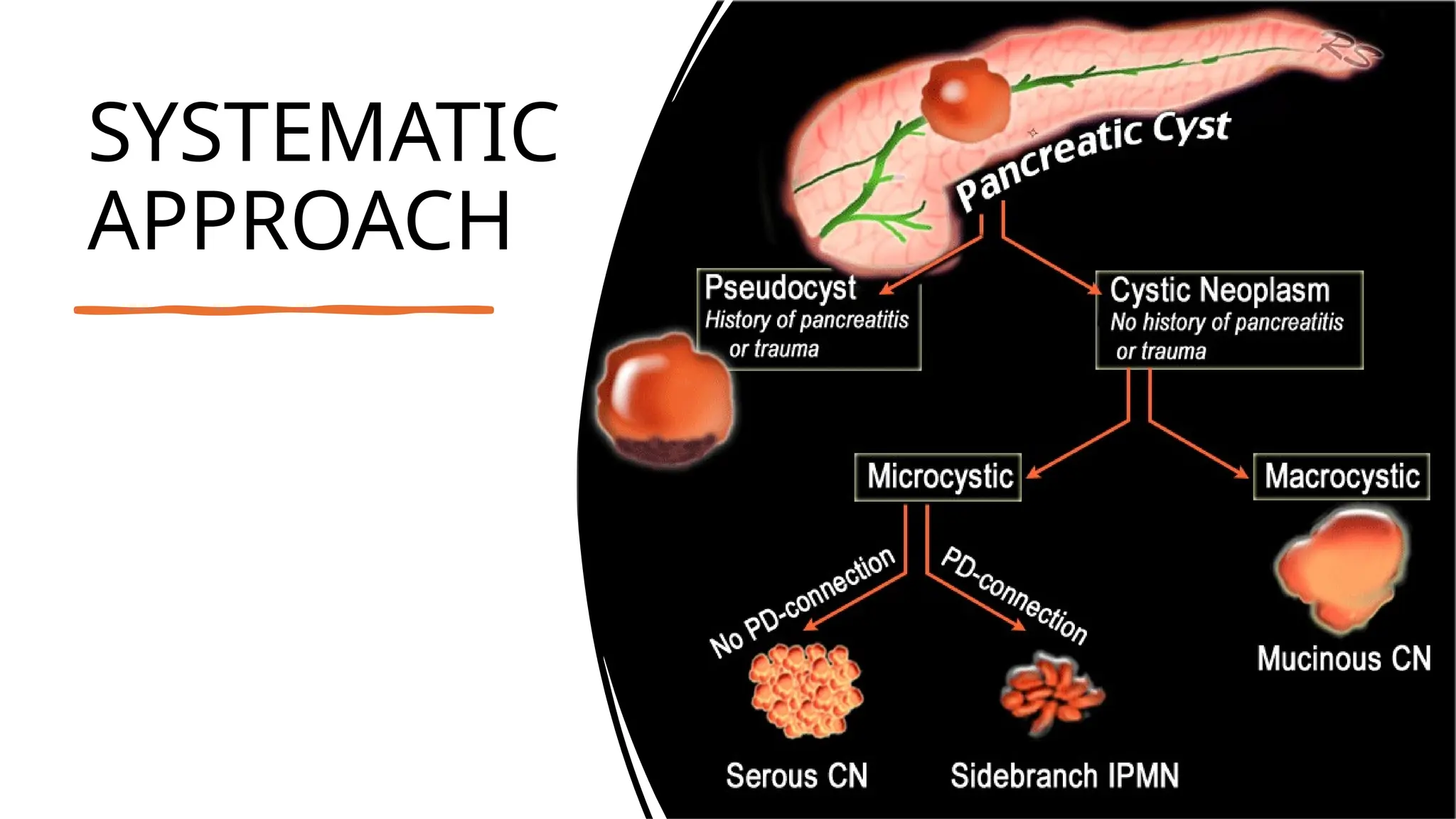 Cystic pancreas lesions power point presentation | PPT