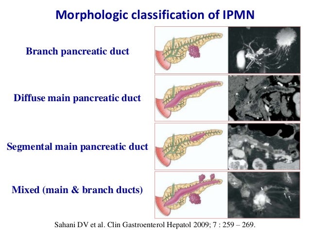 Cystic pancreatic lesions